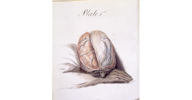 Brain Scans Don’t Catch The Brain In Action – manwithoutqualities
